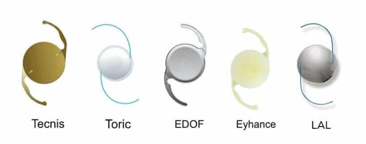 Cataract Surgery Syracuse | Cataracts Liverpool | IOL Self-Test